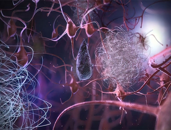 Acumen Announces First Patient Dosed in ALTITUDE-AD - Clinical Trials